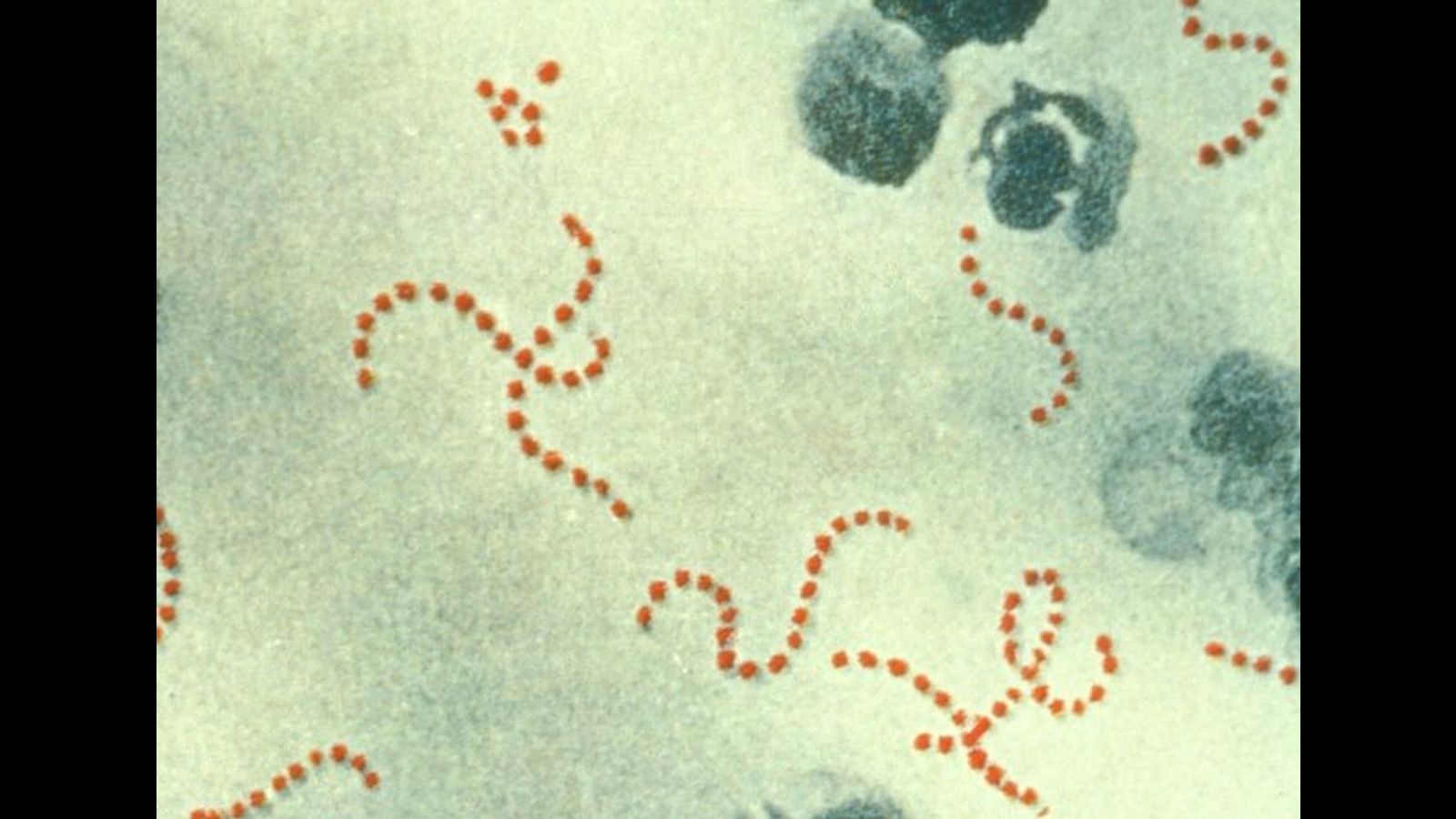 The UK’s Strep A child deaths and the causes of the “tripledemic ...