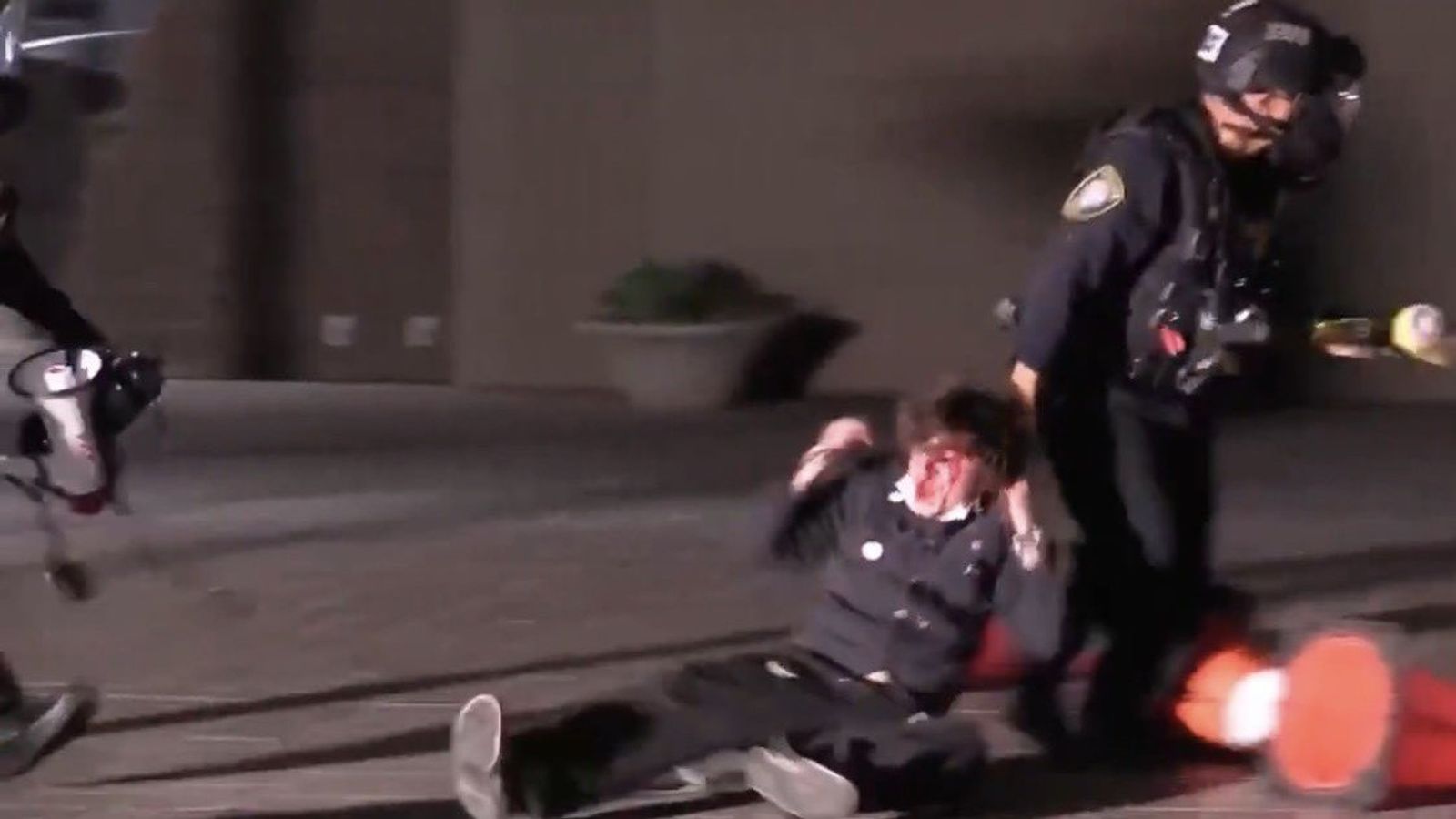 Young protester permanently blinded as DHS agents attack anti-ICE ...